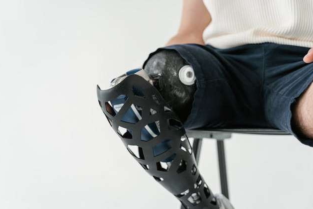 Prosthetics | Advanced Prosthetics